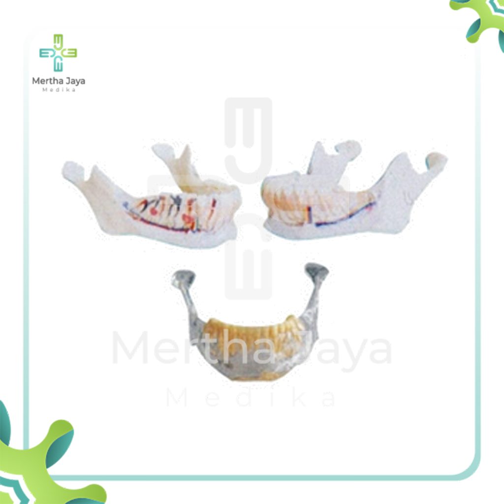 Mandibular Anatomy Model – Mertha Jaya Medika